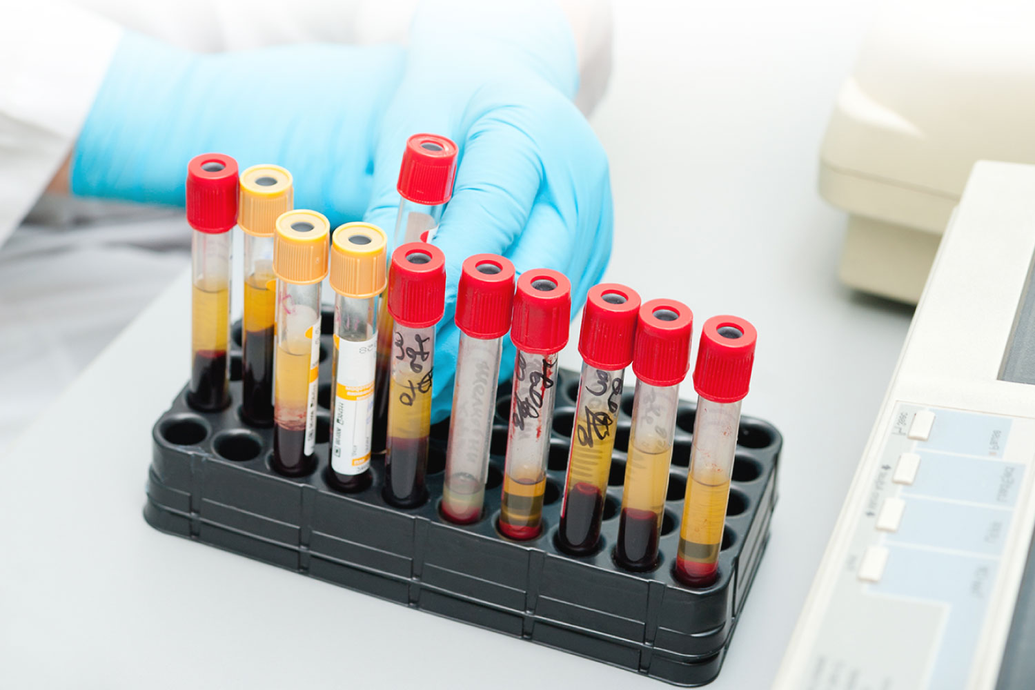 Chelation Therapy Remove Heavy Metals - Dermaster