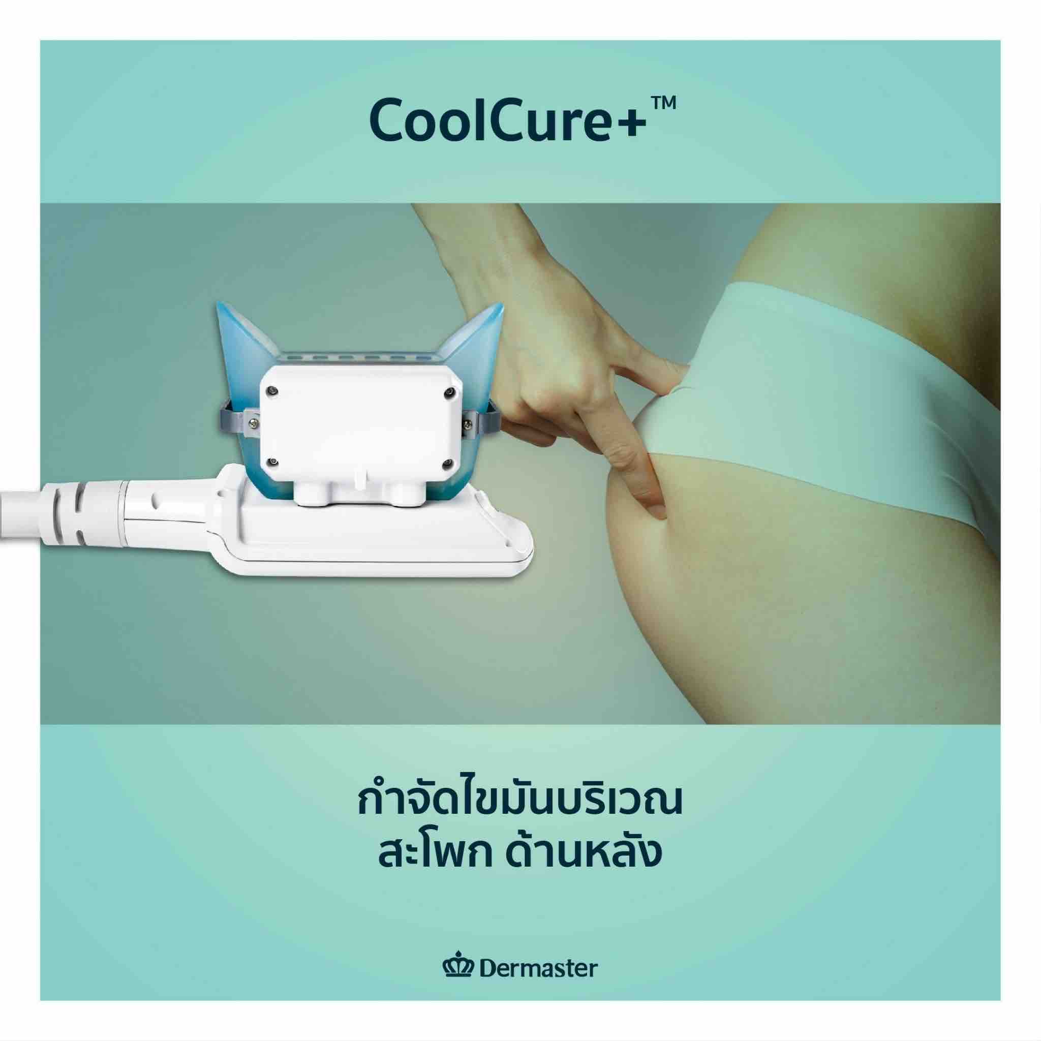 สลายไขมันด้วยความเย็น (Coolsculpting) - Dermaster สถาบันความงาม